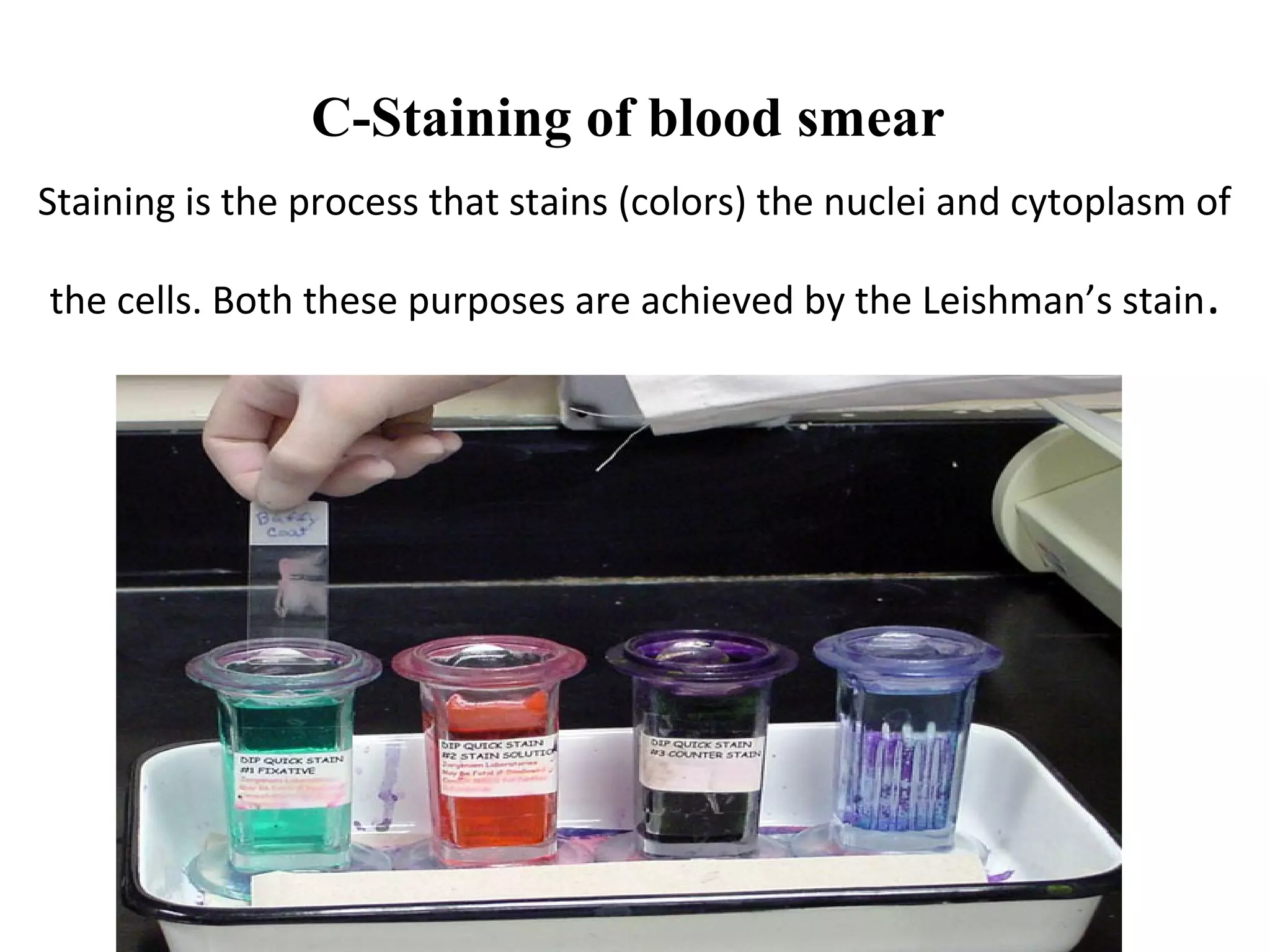 Prepration and staining of blood film | PPT