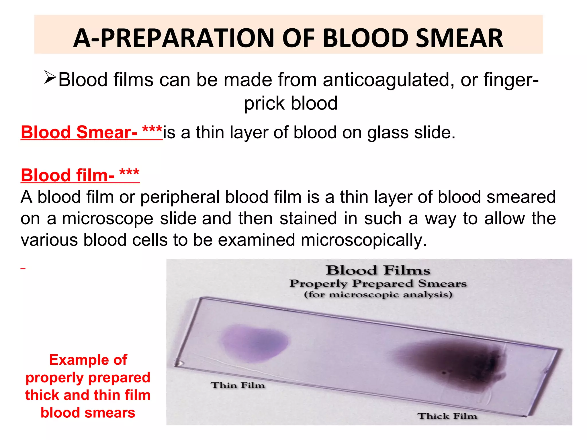 Prepration and staining of blood film | PPT
