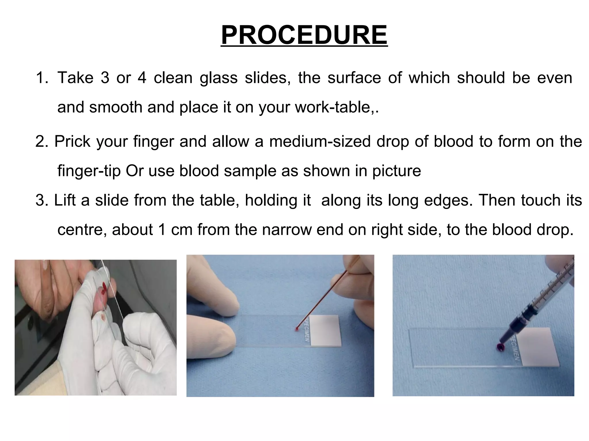 Prepration and staining of blood film | PPT