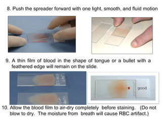 Prepration and staining of blood film | PPT