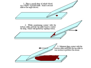 Prepration and staining of blood film | PPT