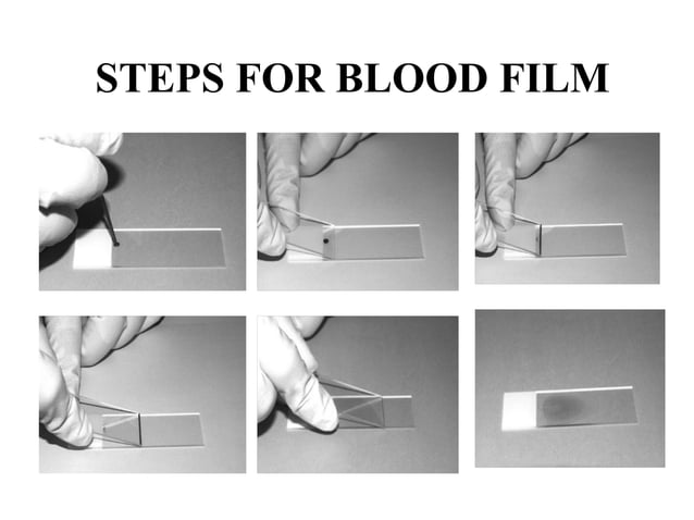 Prepration and staining of blood film | PPT