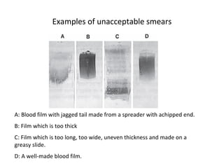 Prepration and staining of blood film | PPT