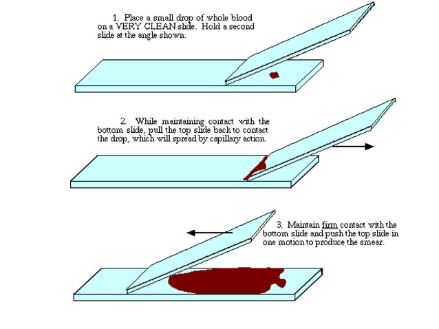 Prepration and staining of blood film