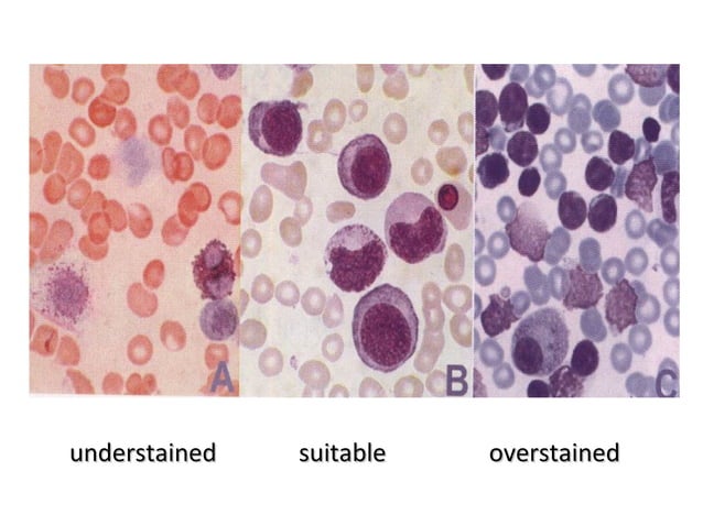 Prepration and staining of blood film