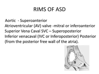 ECHO ASSESSMENT OF ASD FOR DEVICE CLOSURE | PPT