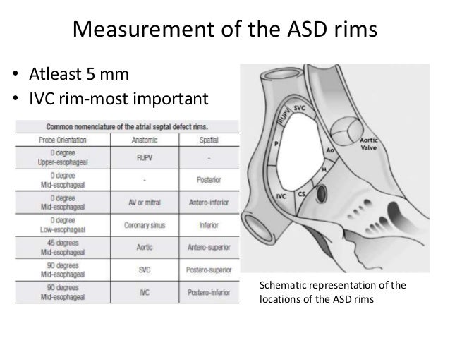 ECHO ASSESSMENT OF ASD FOR DEVICE CLOSURE