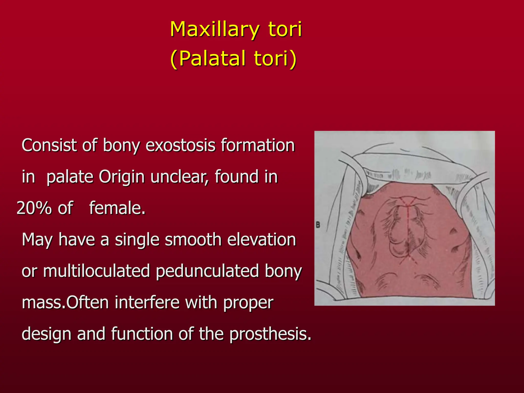 preprosthetic surgery hard and soft tissue.ppt
