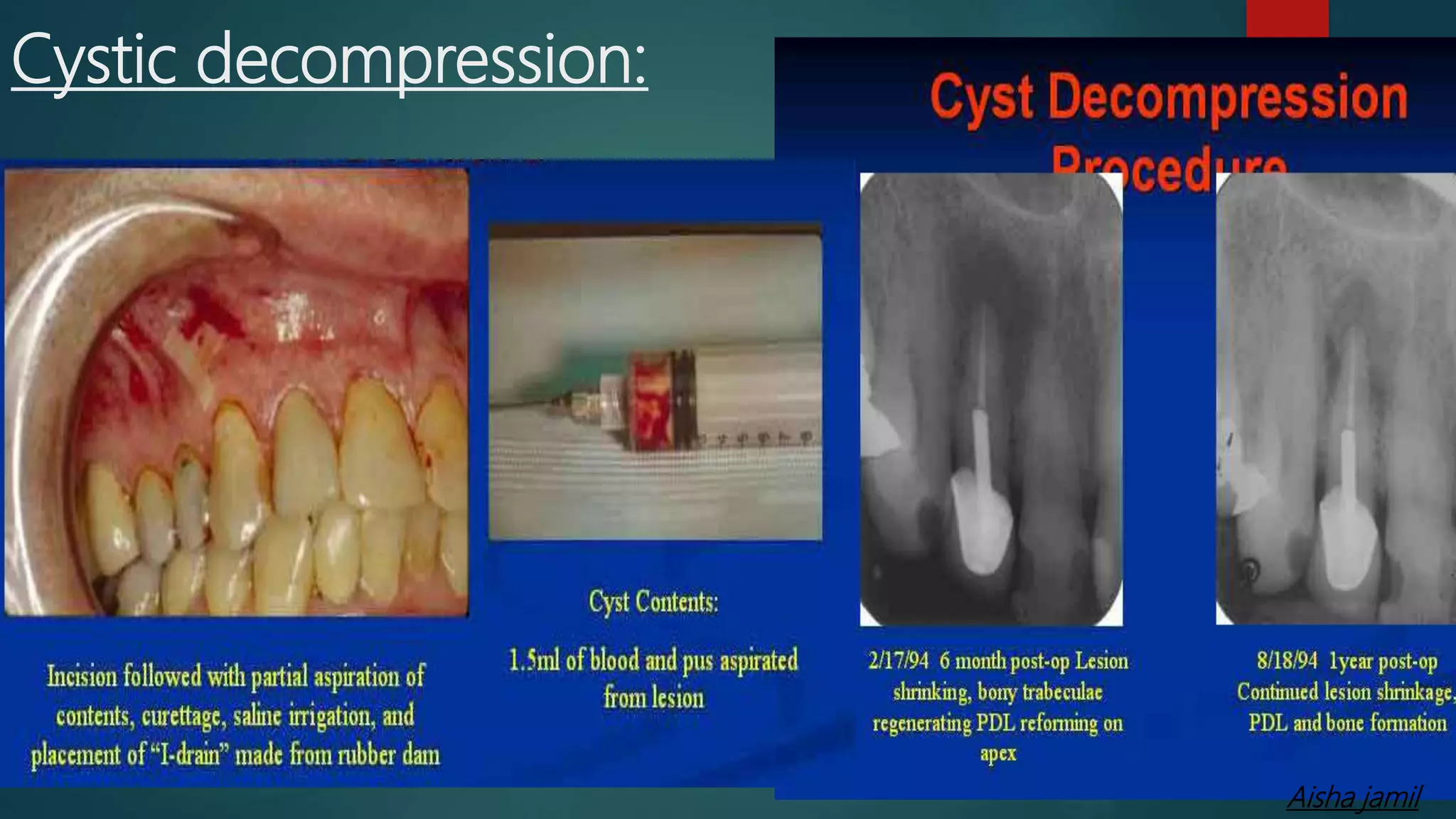 Indications and pre-prosthetic procedures For making prosthesis - DR ...