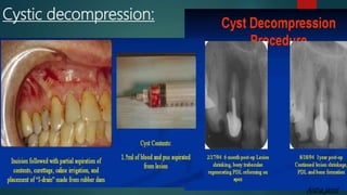 Indications and pre-prosthetic procedures For making prosthesis - DR ...