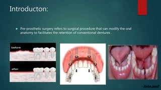 Indications and pre-prosthetic procedures For making prosthesis - DR ...