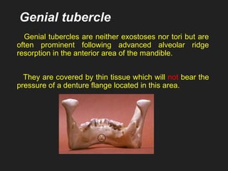 Genial Tubercle Reduction