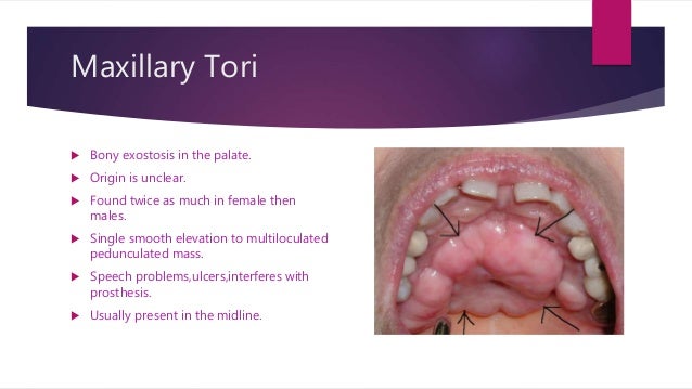 Pre prosthetic surgery
