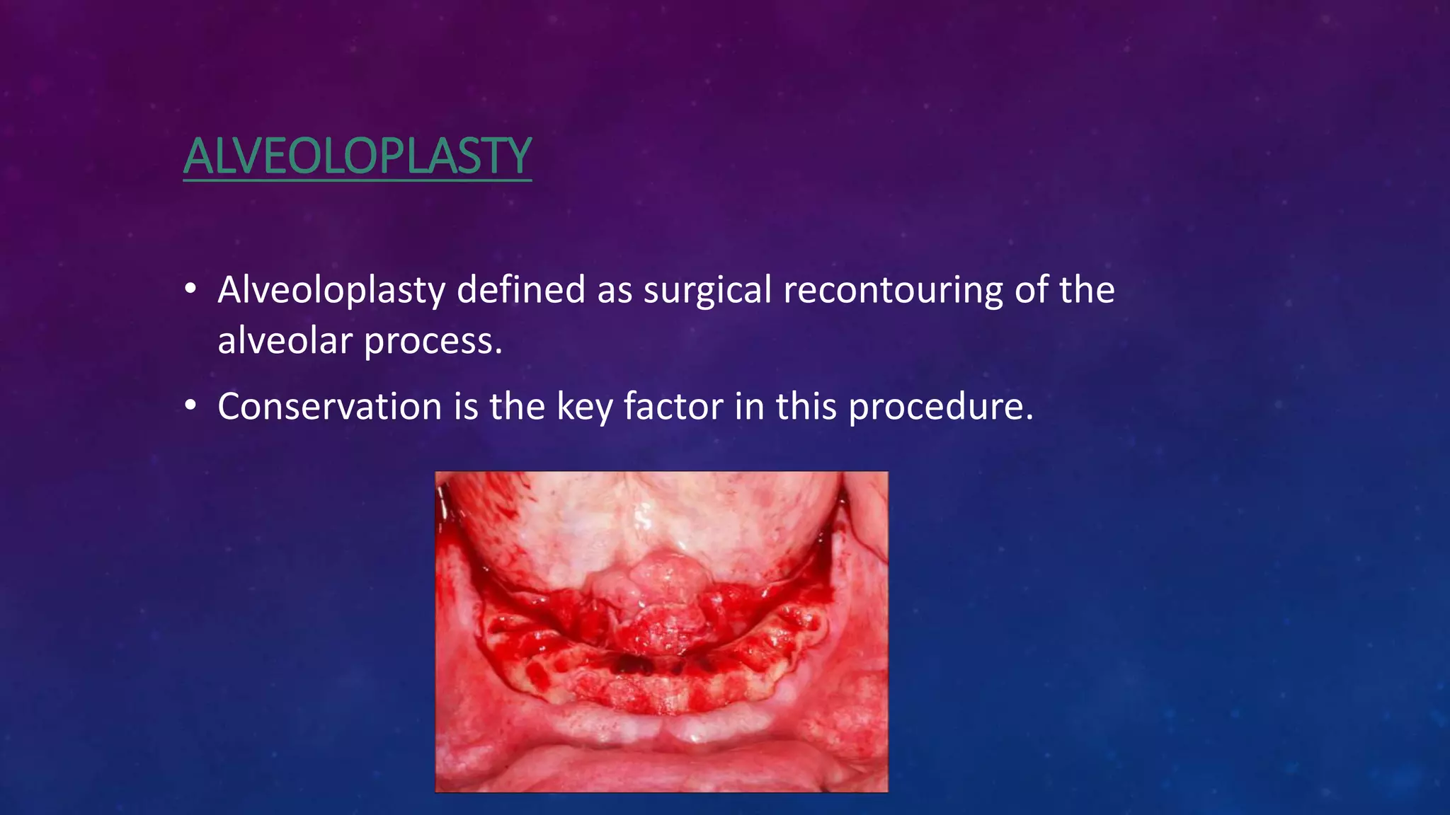 Preprosthetic surgery; Prosthodontic consideraration | PPTX