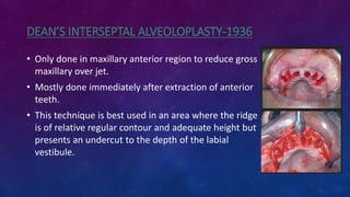 Preprosthetic surgery; Prosthodontic consideraration | PPTX