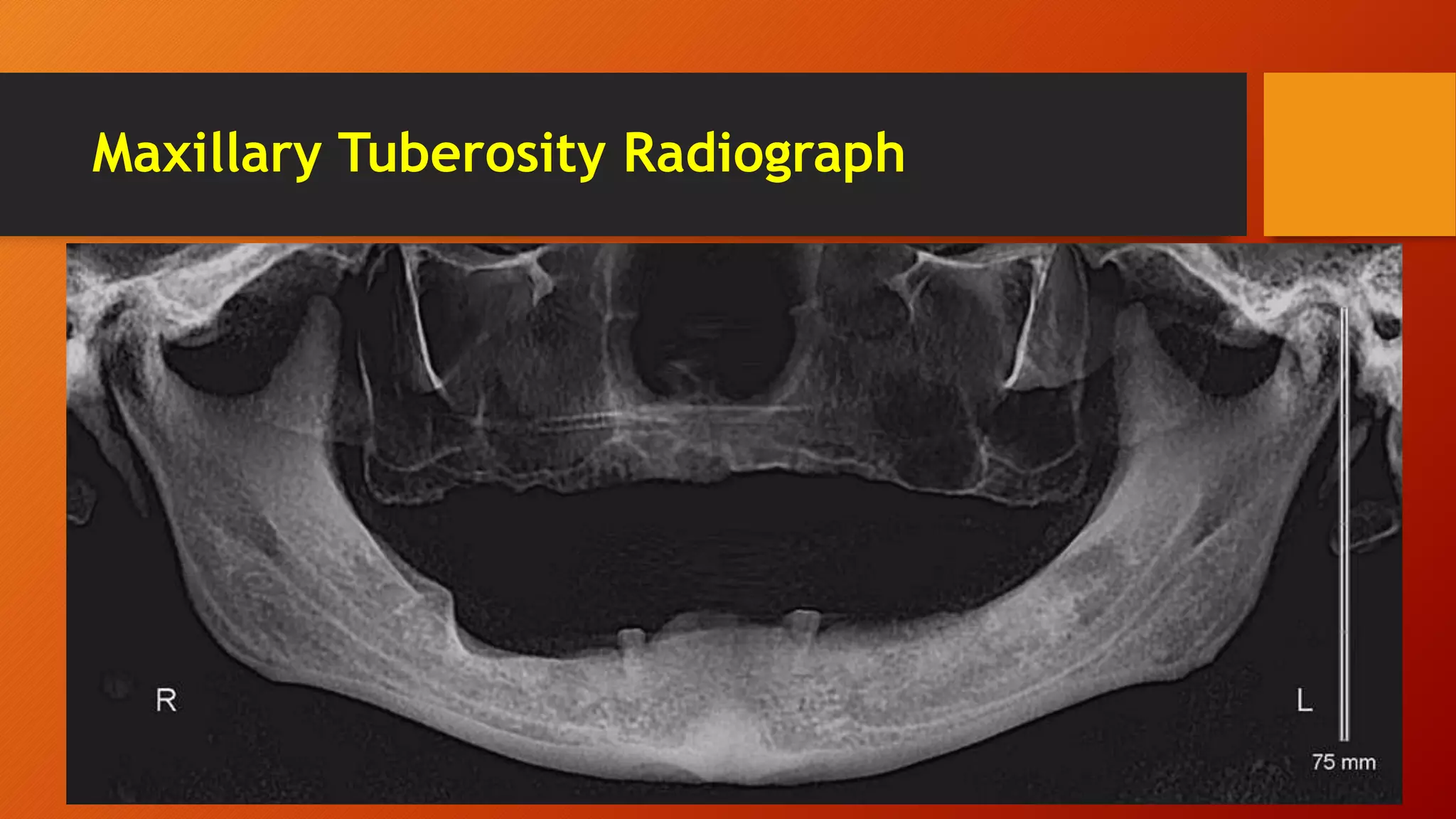 Pre prosthetic surgery | PPTX