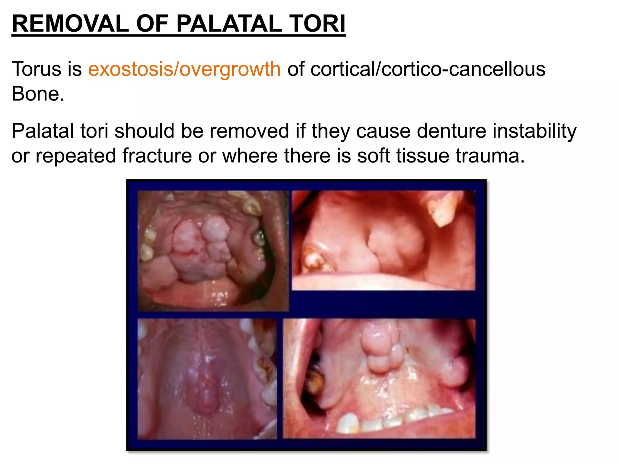 Preprosthetic surgery.pdf