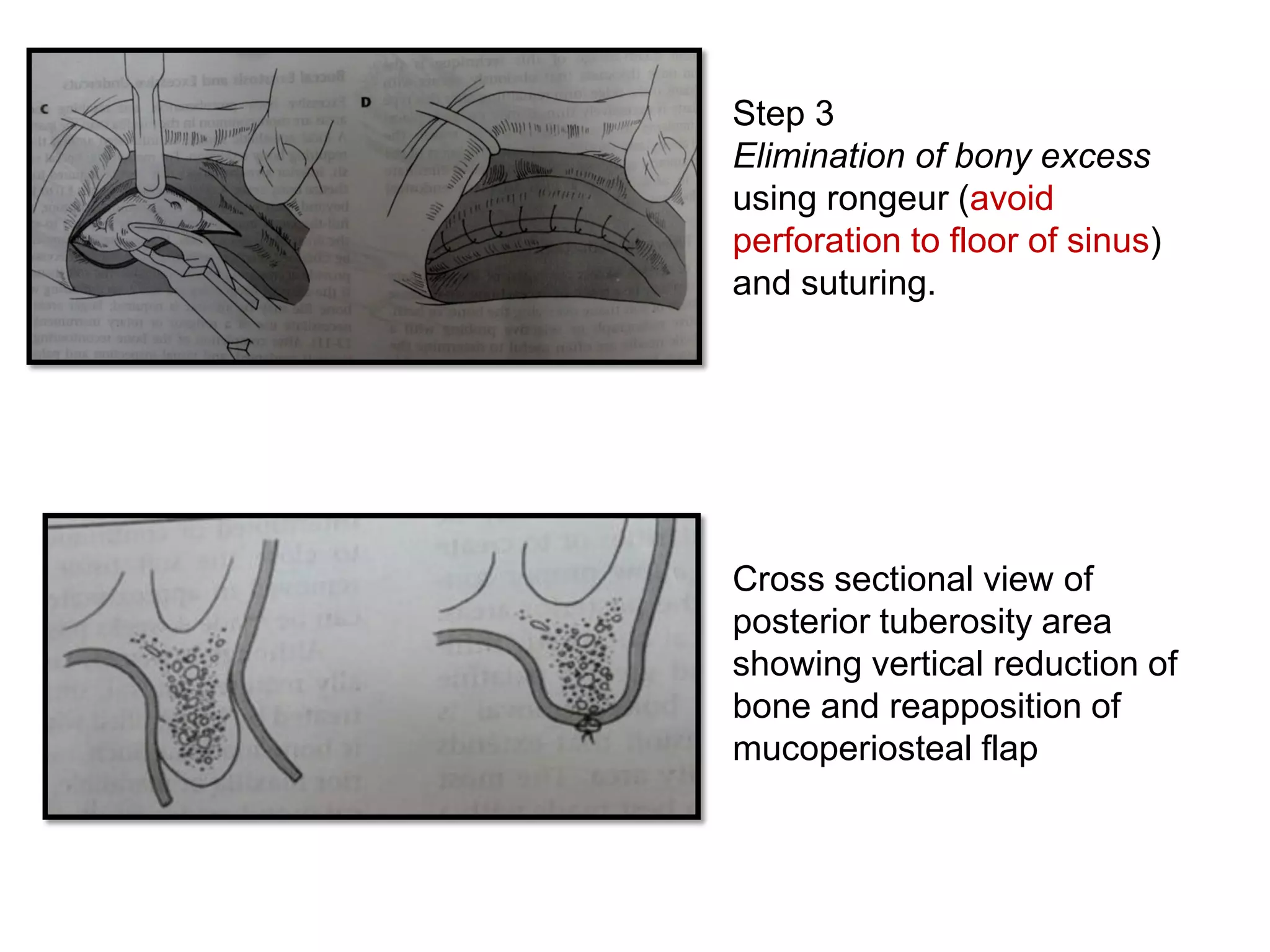 Preprosthetic surgery.pdf