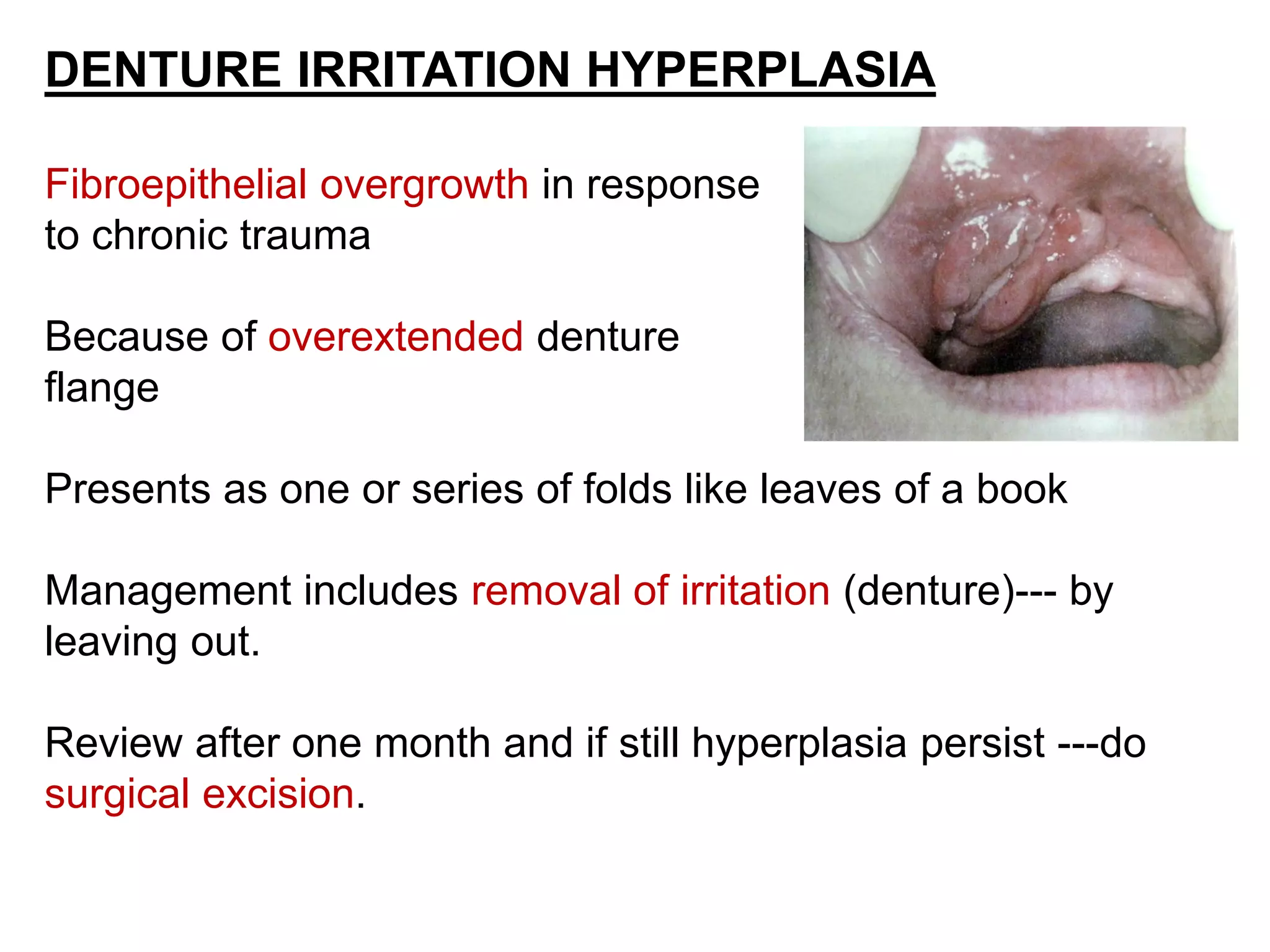 Preprosthetic surgery.pdf