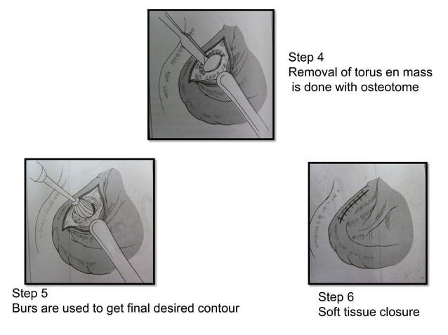Preprosthetic surgery.pdf