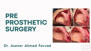 Pre prosthetic surgery ........... pptx | PPTX