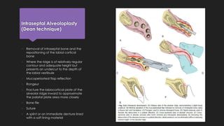 Preprosthetic oromaxillofacial Surgery.pptx