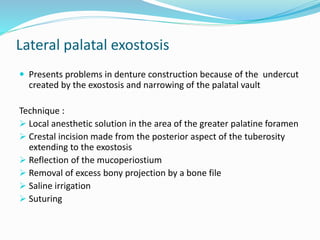 Pre prosthetic surgery | PPTX