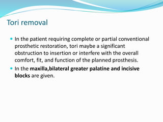 Pre prosthetic surgery | PPTX