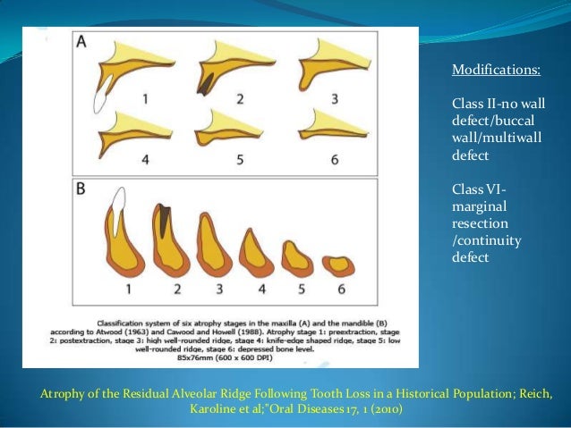 Pre prosthetic surgery (2)
