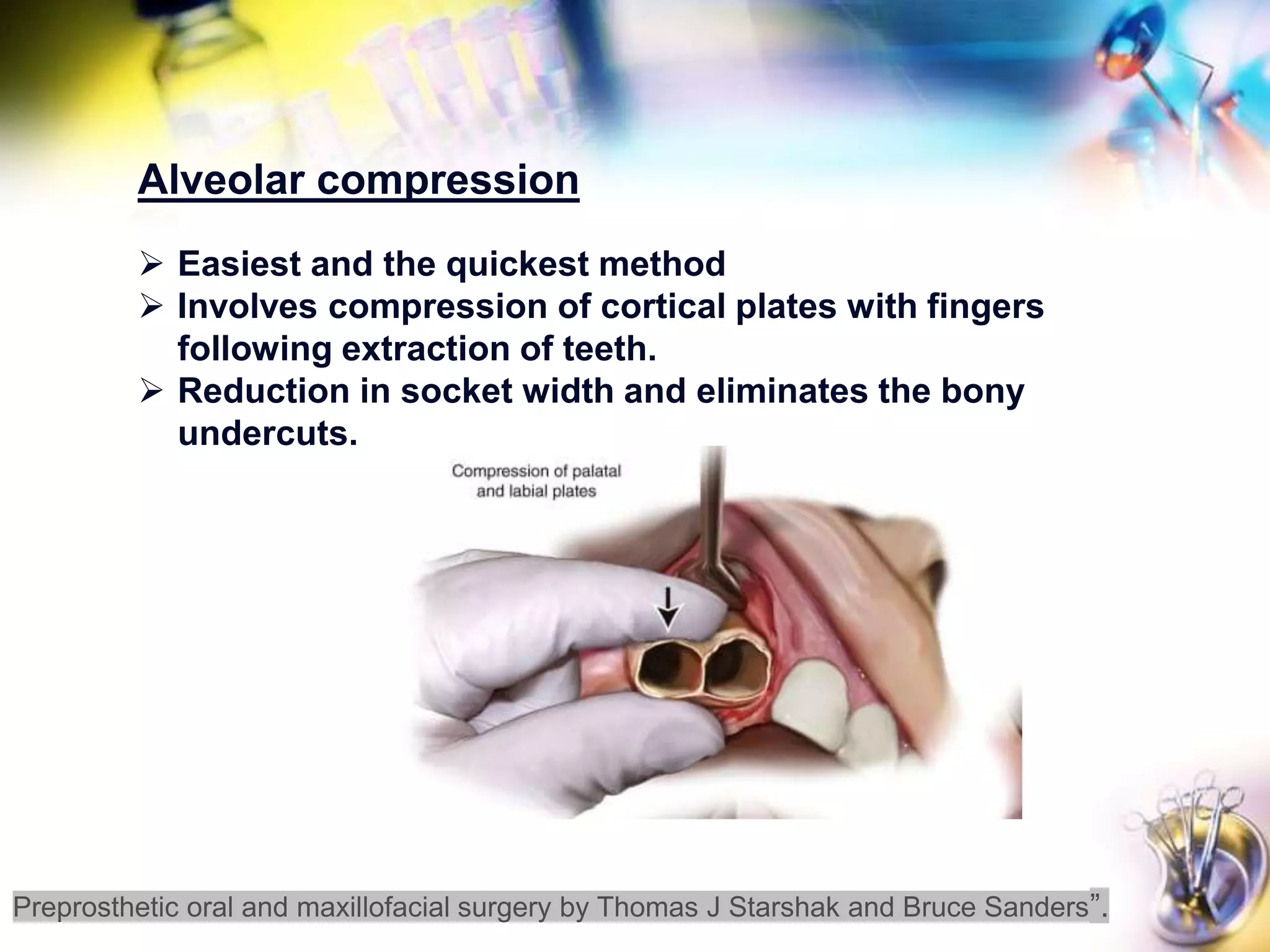 PREPROSTHETIC SURGERY 2.pptx