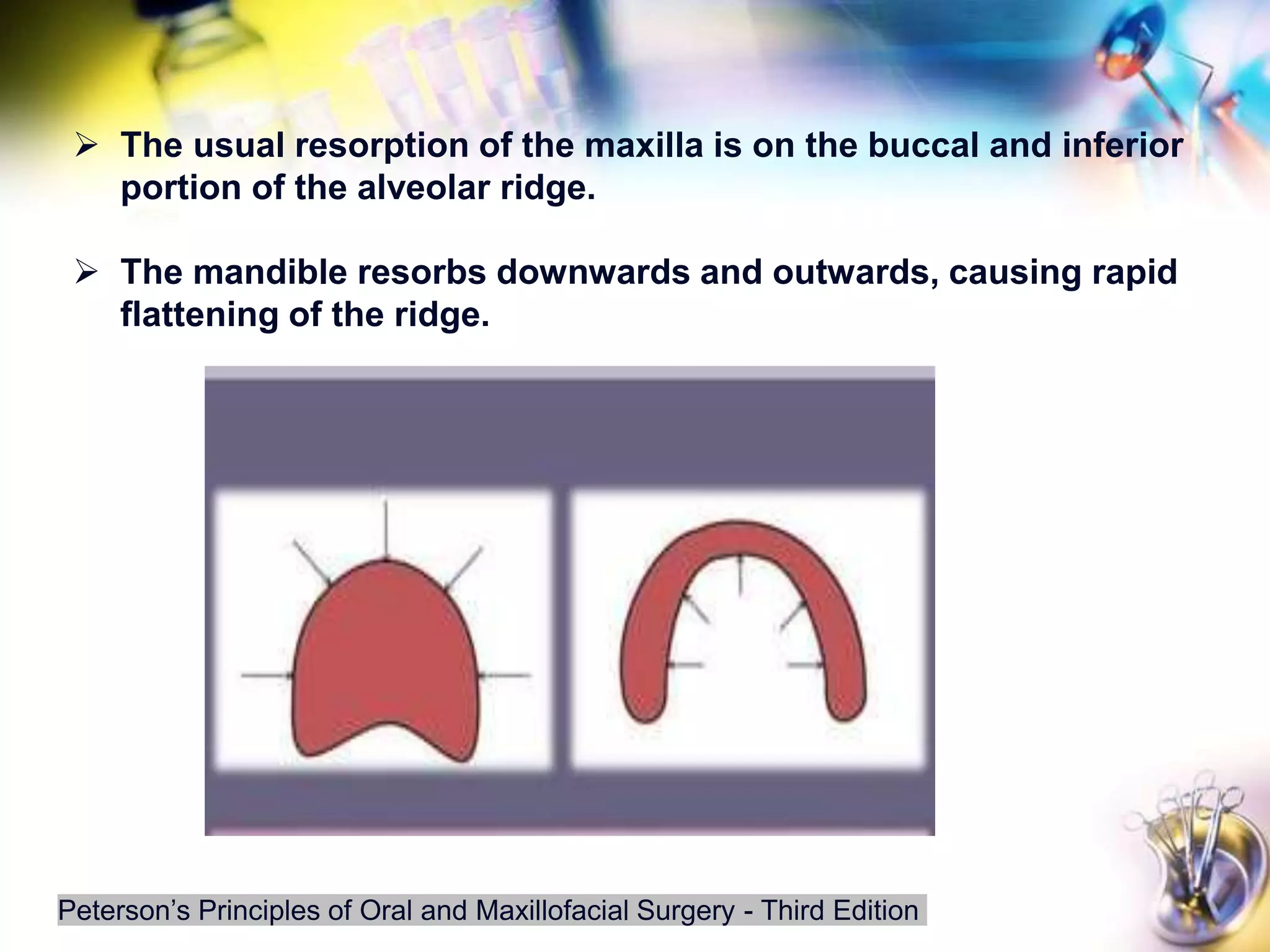 PREPROSTHETIC SURGERY 2.pptx