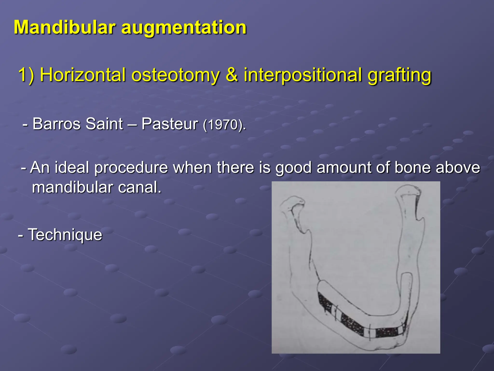 Preprosthetic surgery - ridge correction 2.ppt