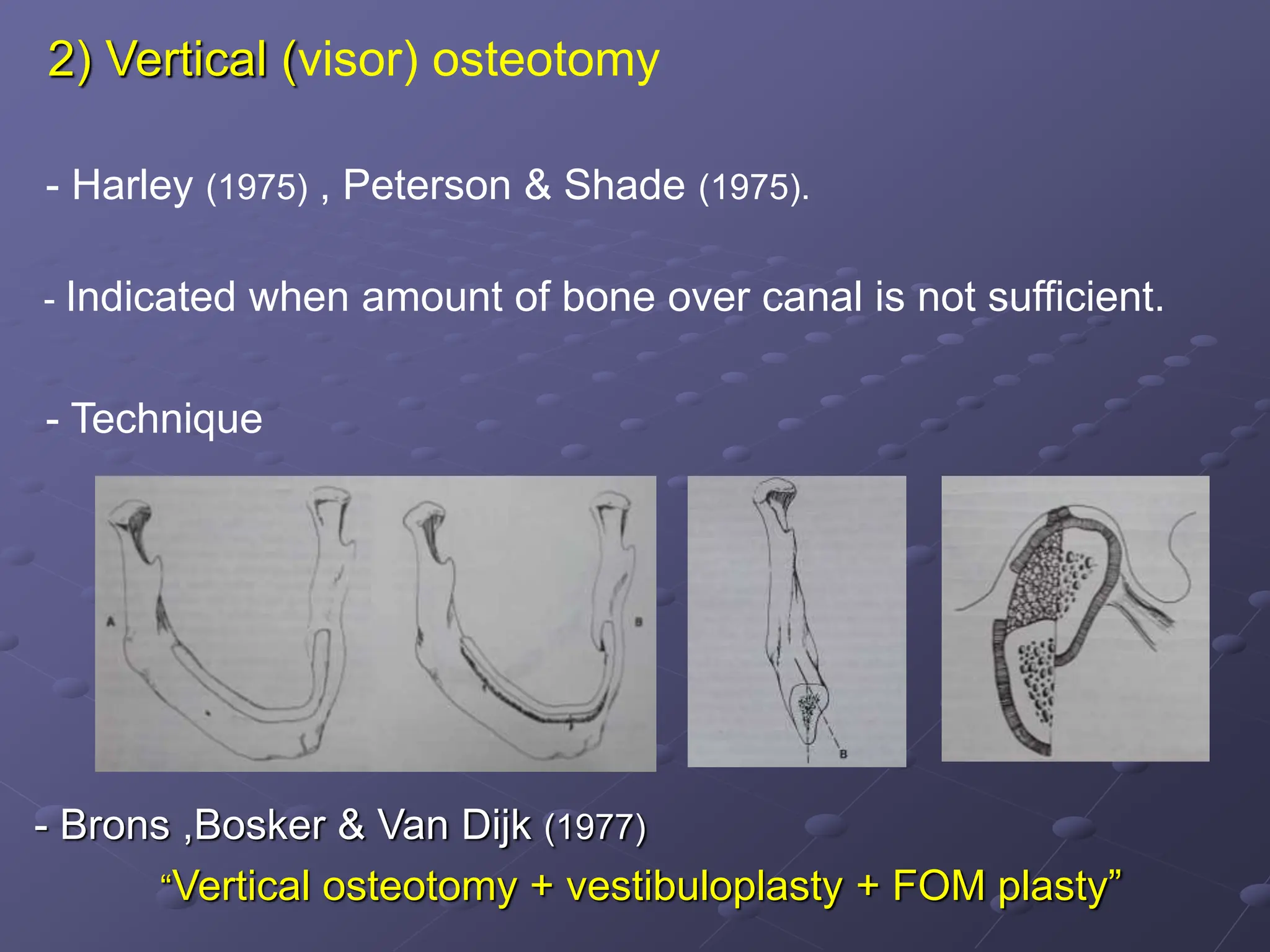 Preprosthetic surgery - ridge correction 2.ppt