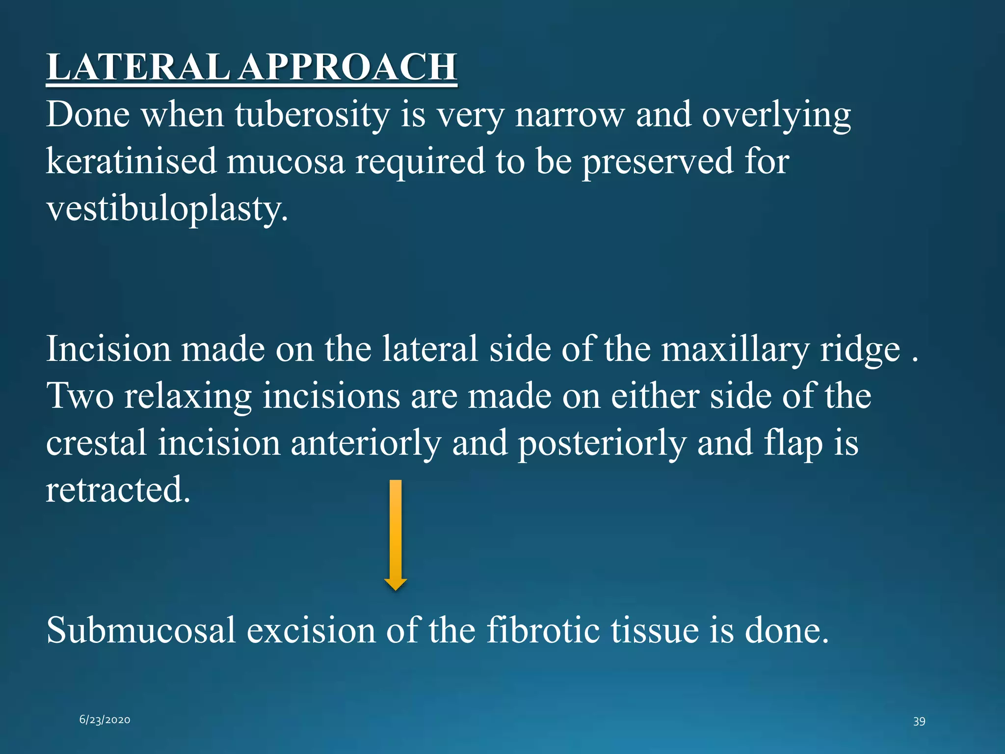 Preprosthetic surgery of maxilla | PPTX
