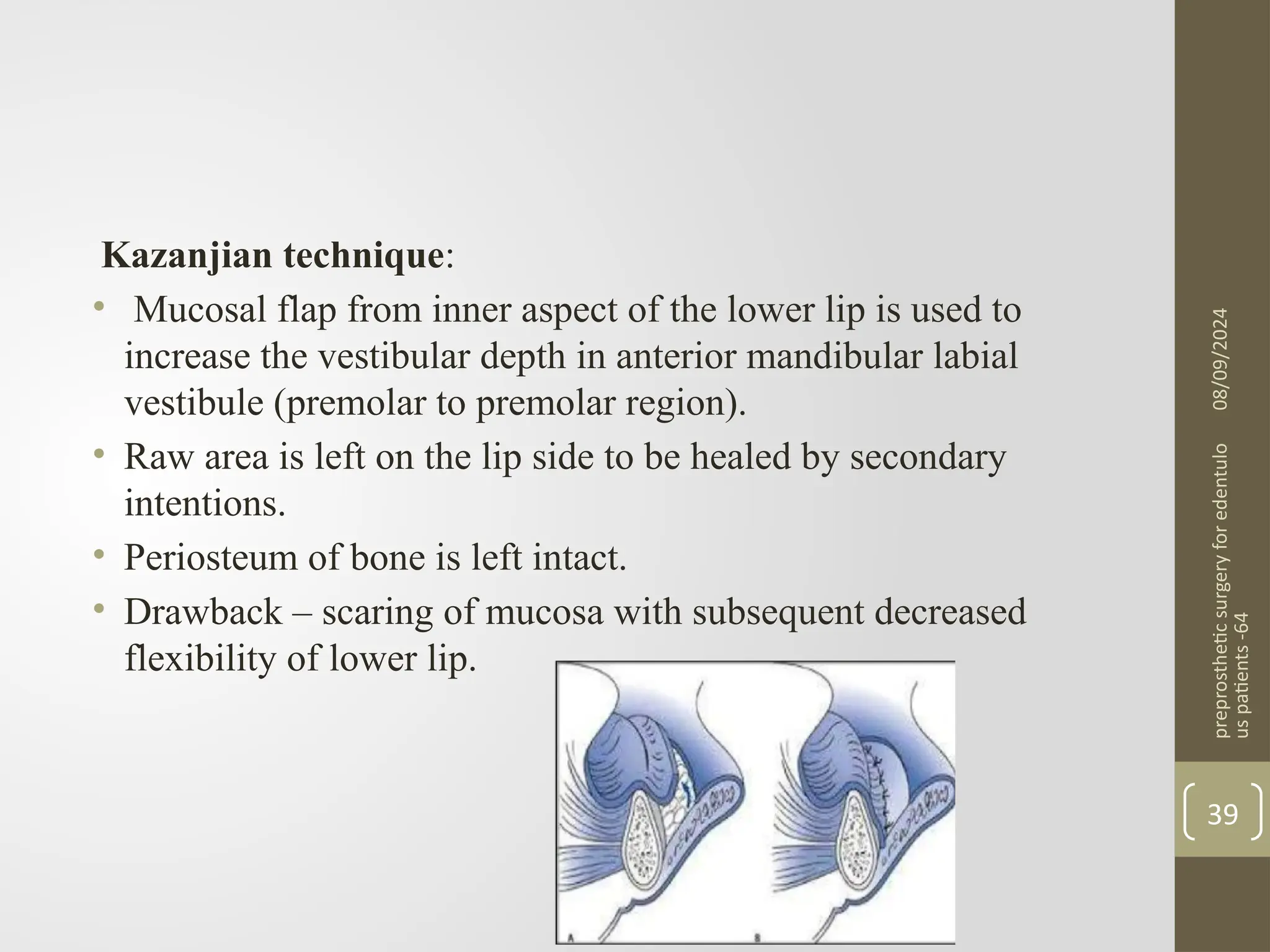 preprosthetic surgery seminar finalppt.pptx