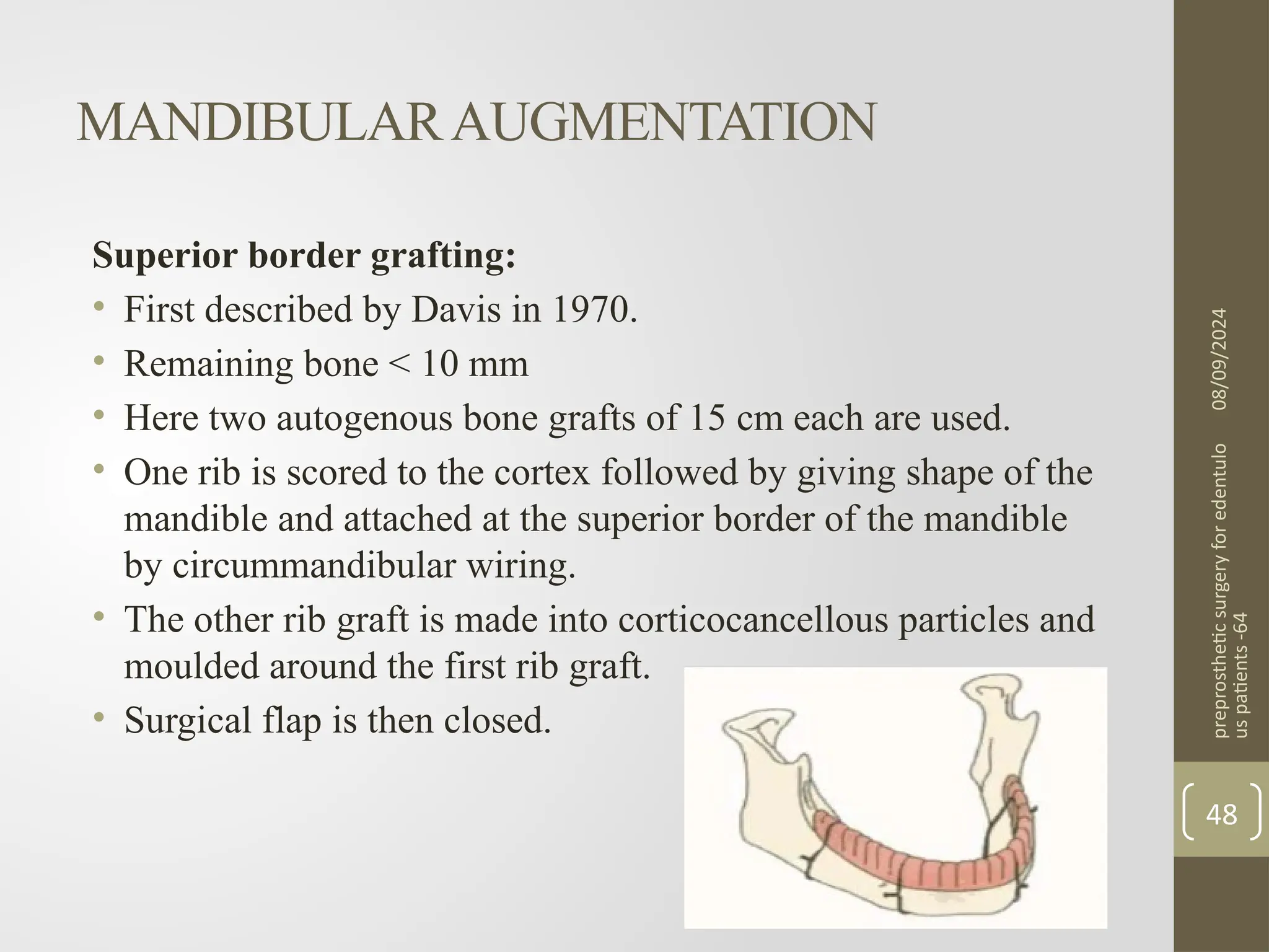 preprosthetic surgery seminar finalppt.pptx