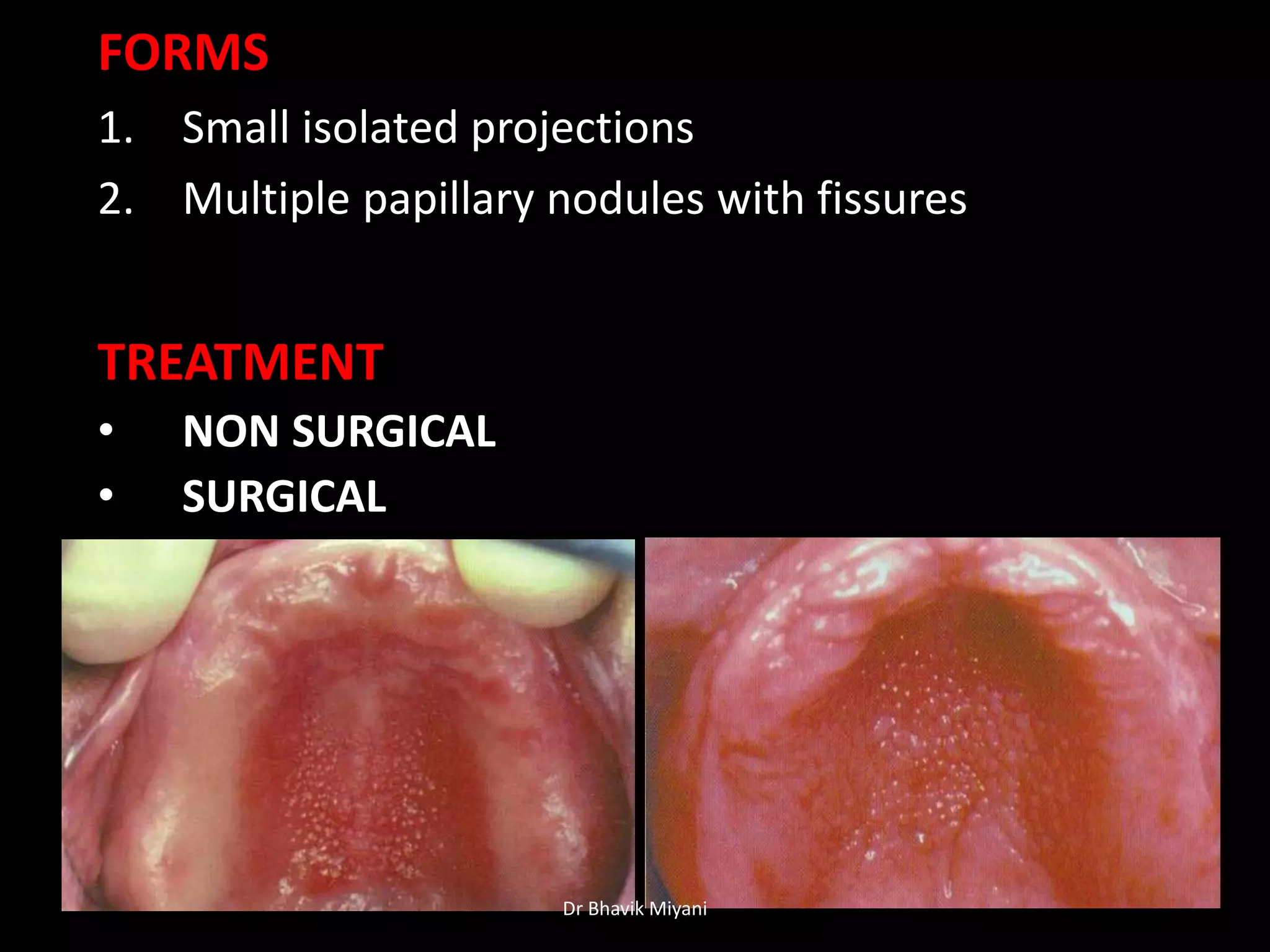 Pre-Prosthetic Surgery | PPT