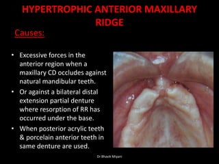 Pre-Prosthetic Surgery | PPT