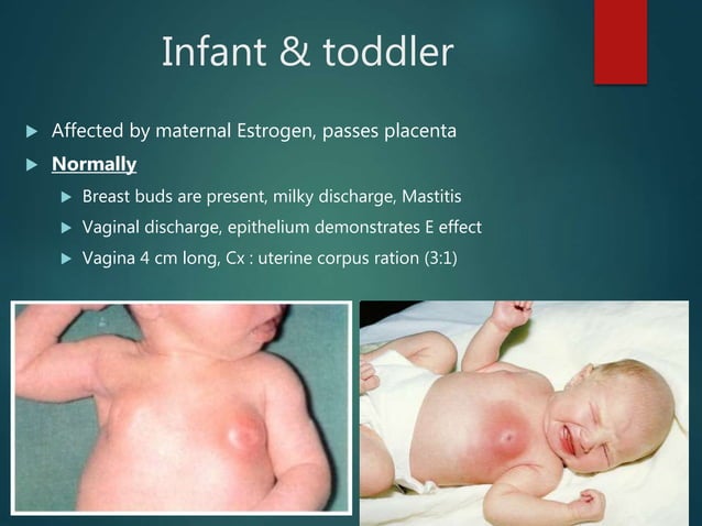 Prepubertal bleeding | PPTX