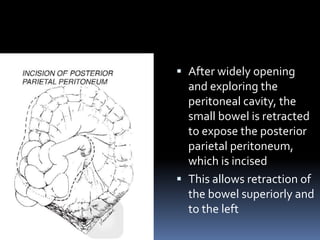 Pre requisites for cadaver kidney retrieval & technique | PPTX