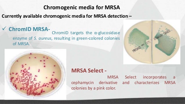 Prerit credit seminar
