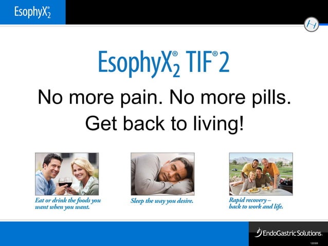 Patient info for TIF/endoscopic gastric fundoplication | PPT