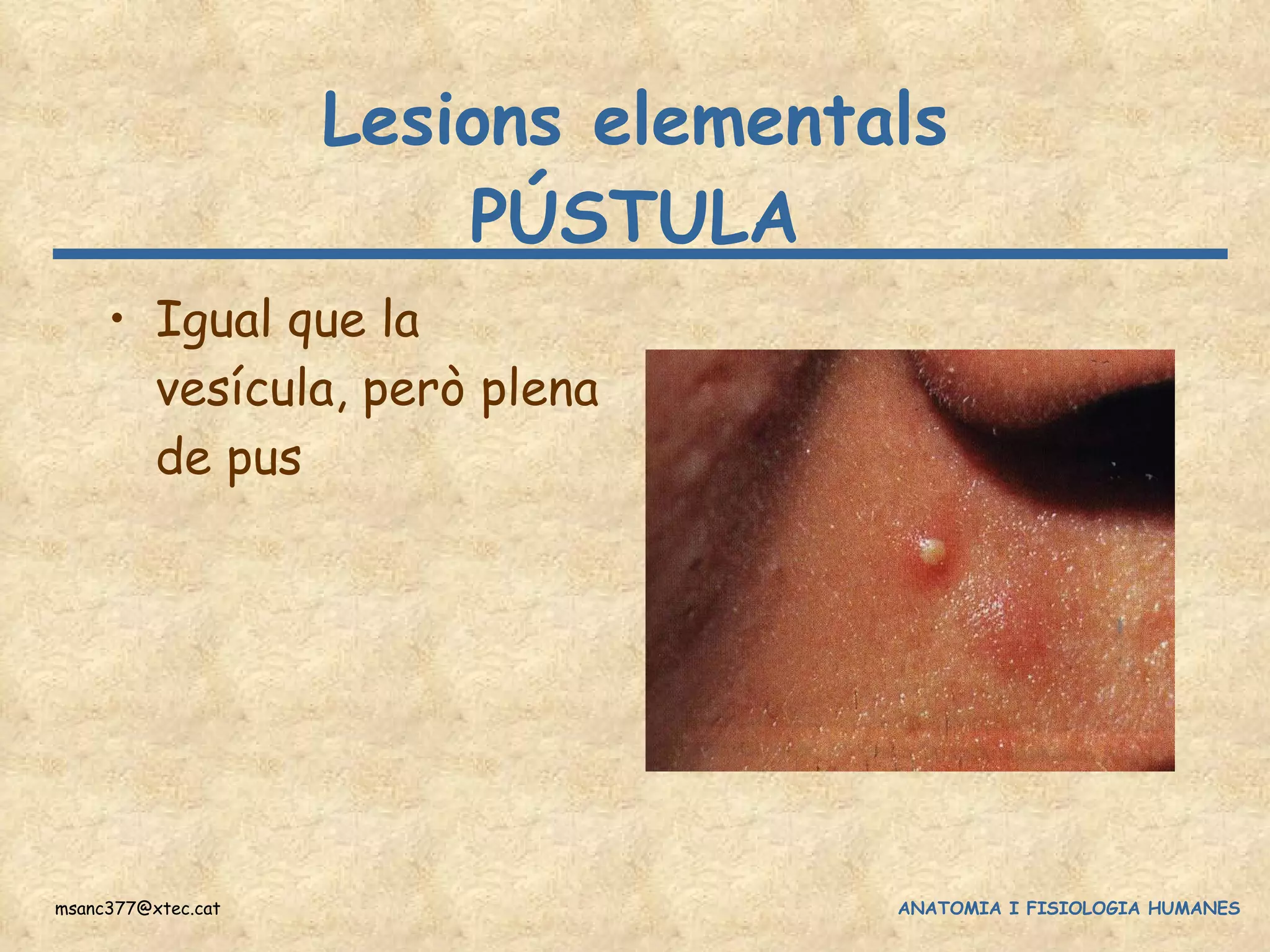 La Pell - Lesions Elementals | PPT