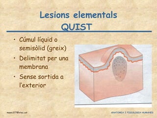 La Pell - Lesions Elementals | PPT