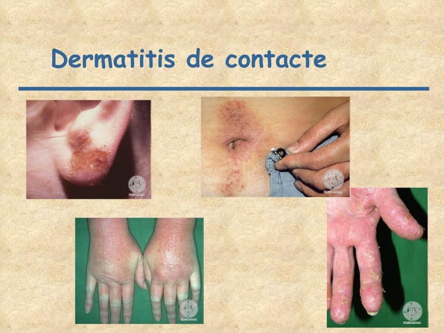 La pell: patologia no infecciosa | PPT