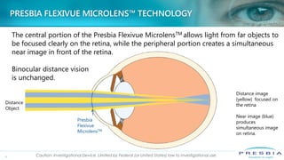 Ophthalmology Innovation Showcase 2 - Presbia | PPT