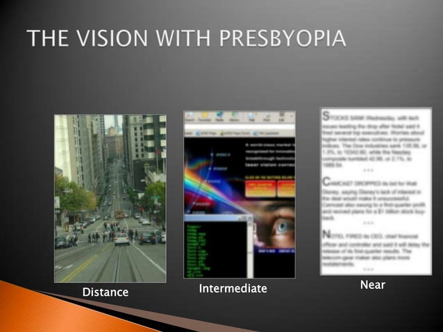 Presbyopia | PPTX