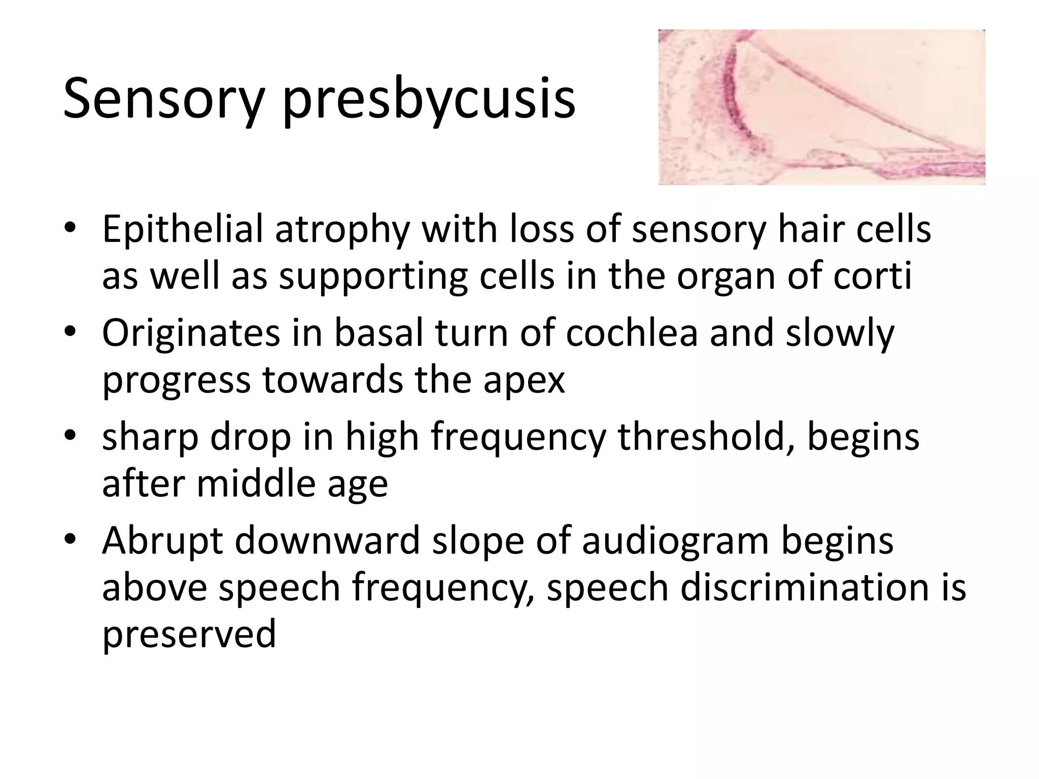 Presbycusis, deafness of old age | PPTX