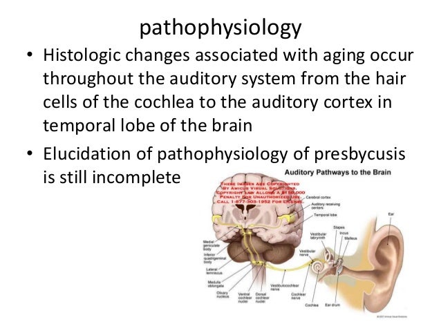 Presbycusis, deafness of old age