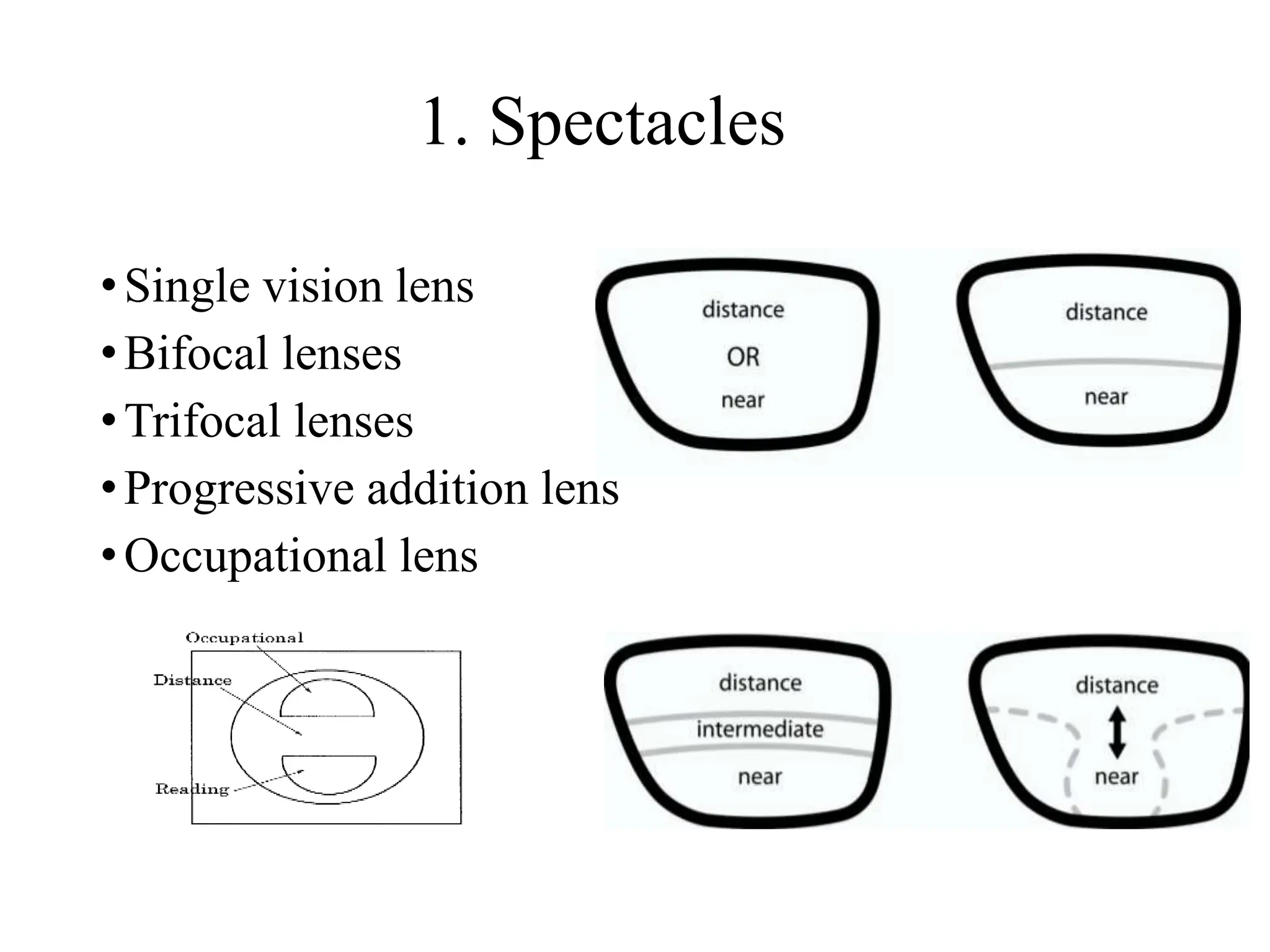 Presbyopia - refraction and management-Archana.pptx